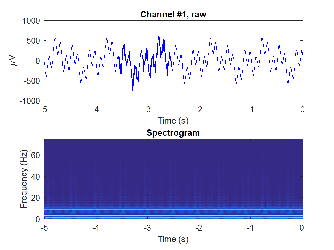 Online Spectogram in Matlab - Ripple Neuromed